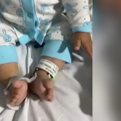 Noticias Medellín: Wyatt, el milagro de vida en Bello, Bebé sobrevivió
